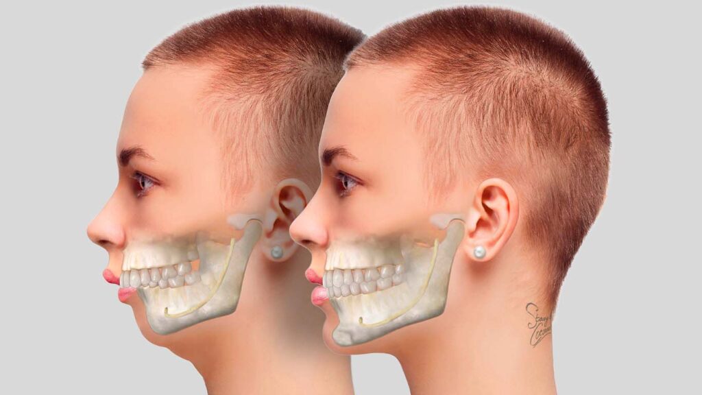 Sorriso Transformado: Ortognática com Dr. Dimas Albertiny